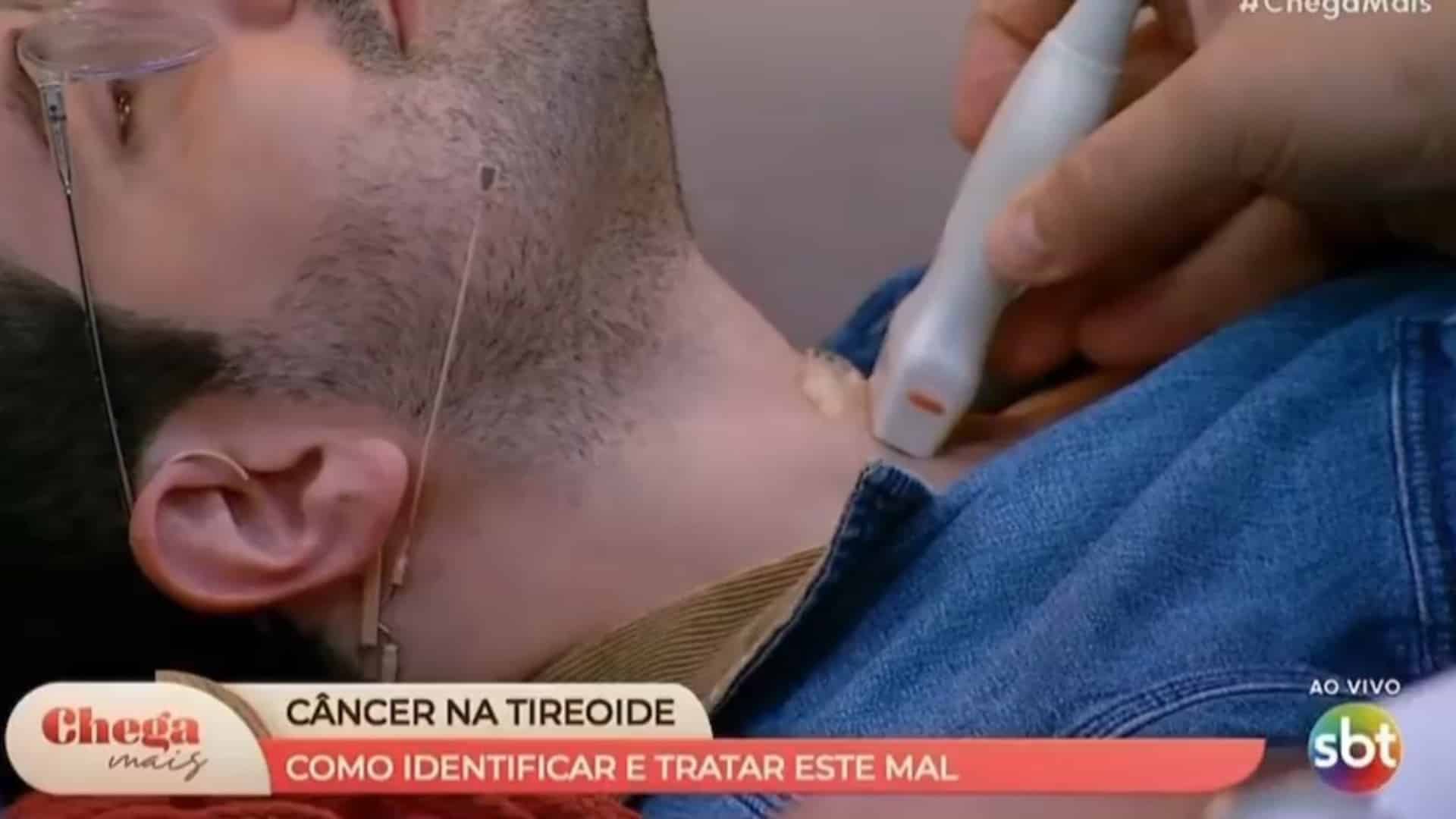 Paulo Mathias descobre nódulo no pescoço durante exame feito em rede ...